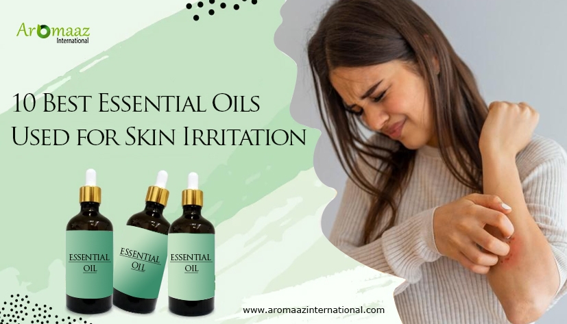 10 Best Essential Oils Used for Skin Irritation - Aromaaz International ...